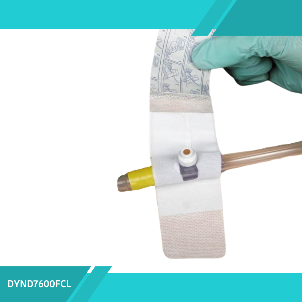 Asegure su sonda con precisión: – Todo Medica